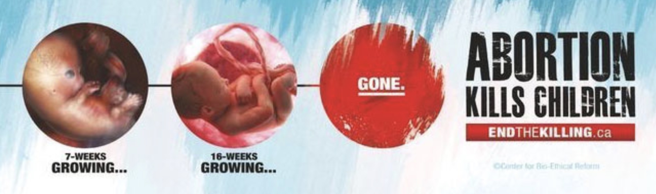 Judge Upholds Ban on Pro-Life Bus Ad — Here’s Why – Faithwire