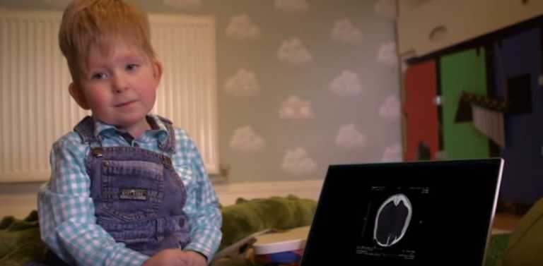 ‘Miracle Child’: Boy Born ‘Without a Brain’ Is Absolutely Thriving ...