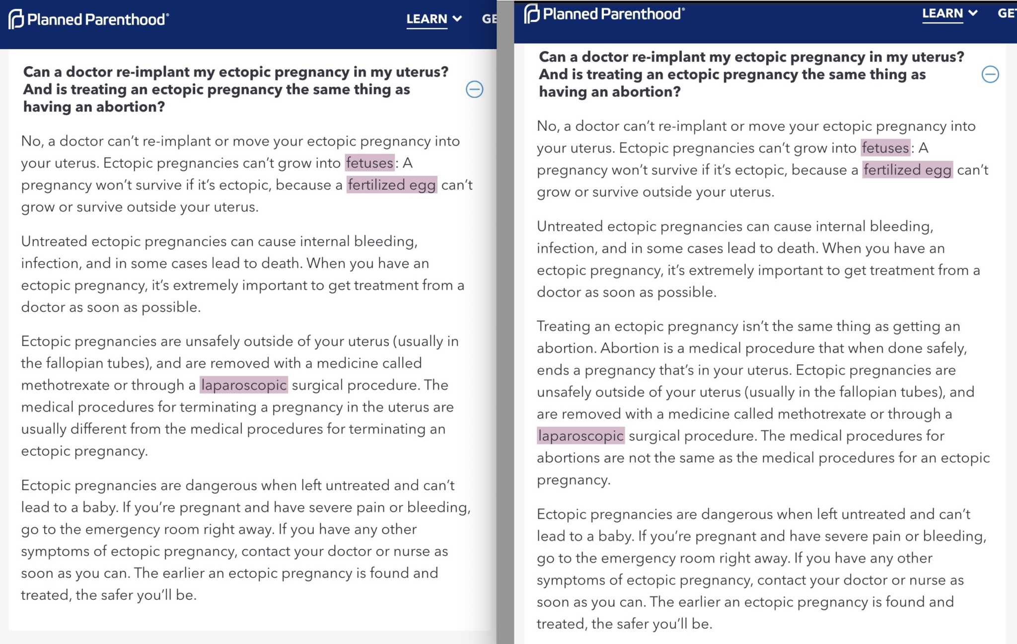 Planned Parenthood’s Two Major Moves on Ectopic Pregnancy and Fetal ...
